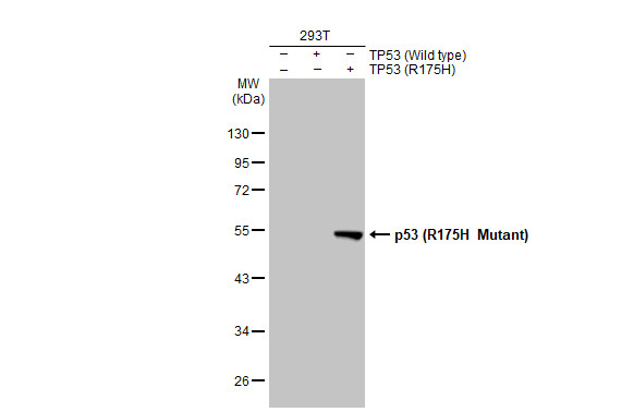 Anti-p53 (R175H Mutant) antibody [HL1129] (GTX636395) | GeneTex