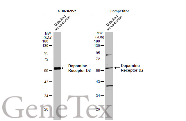Anti-Dopamine Receptor D2 antibody [HL1478] (GTX636952) | GeneTex