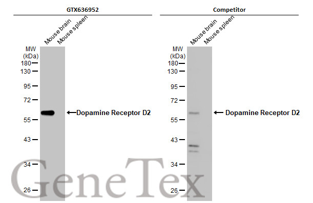 Anti-Dopamine Receptor D2 antibody [HL1478] (GTX636952) | GeneTex