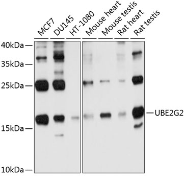 Anti-UBE2G2 antibody (GTX64782) | GeneTex