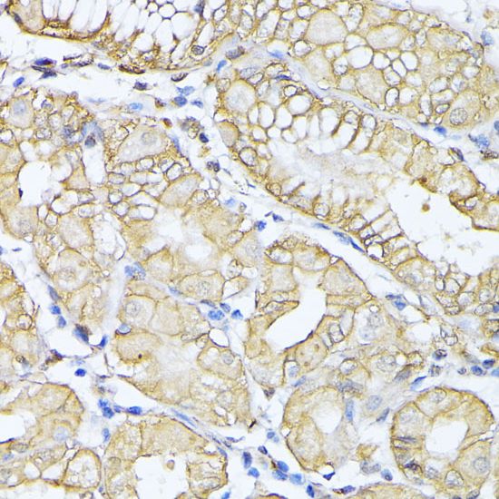 Anti-alpha Fodrin antibody (GTX66033) | GeneTex