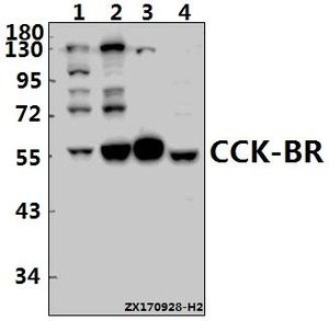Anti-CCKBR antibody (GTX66711) | GeneTex