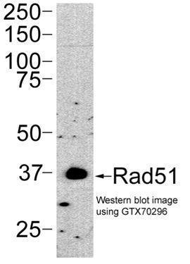 Anti-Rad51 antibody [13E4] (GTX70296) | GeneTex