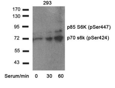 Anti-p70 S6K (phospho Ser424) antibody (GTX78978) | GeneTex