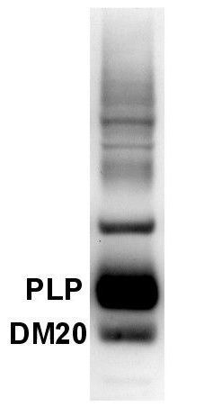 Anti-Myelin PLP antibody (GTX79242) | GeneTex