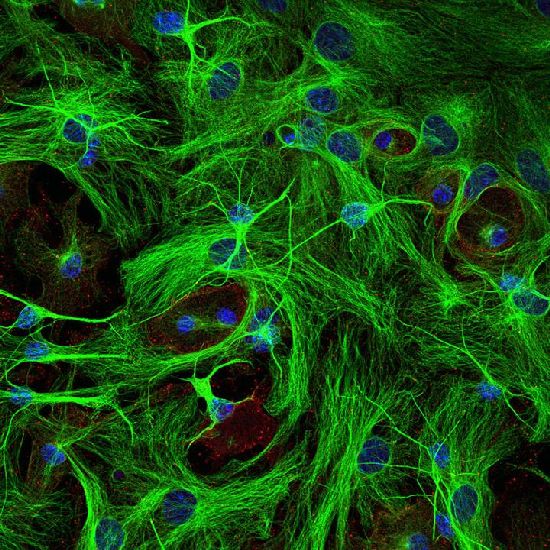 Anti-beta Tubulin 3/ Tuj1 antibody (GTX85469) | GeneTex