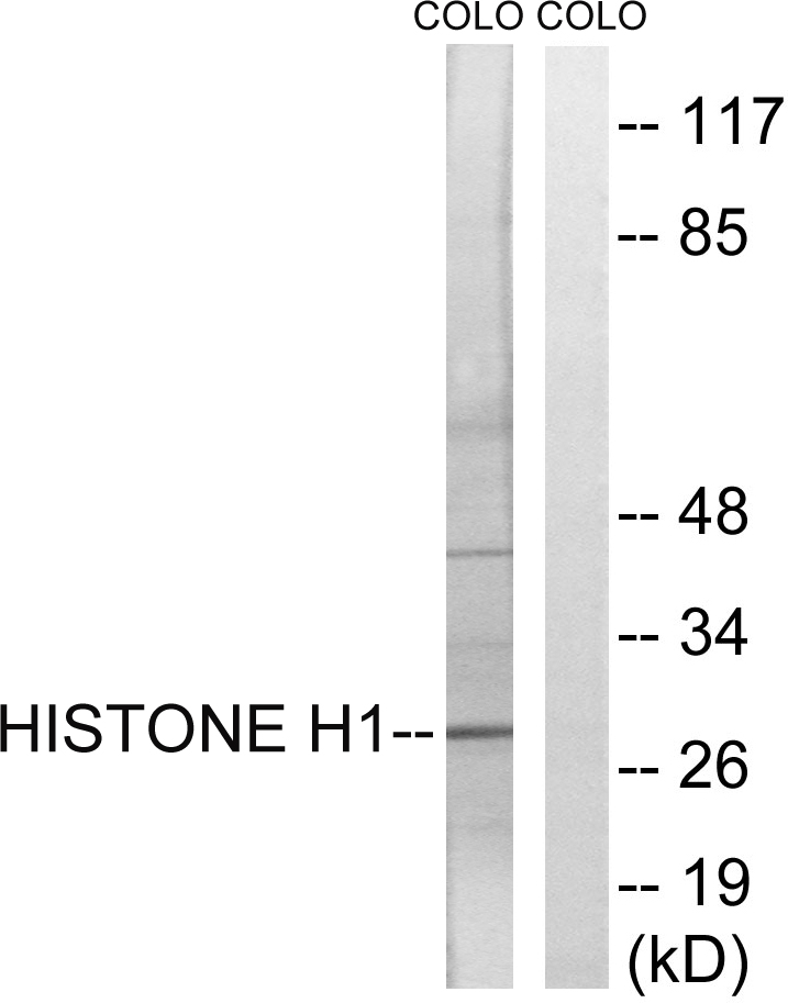Anti-Histone H1 antibody (GTX87506) | GeneTex