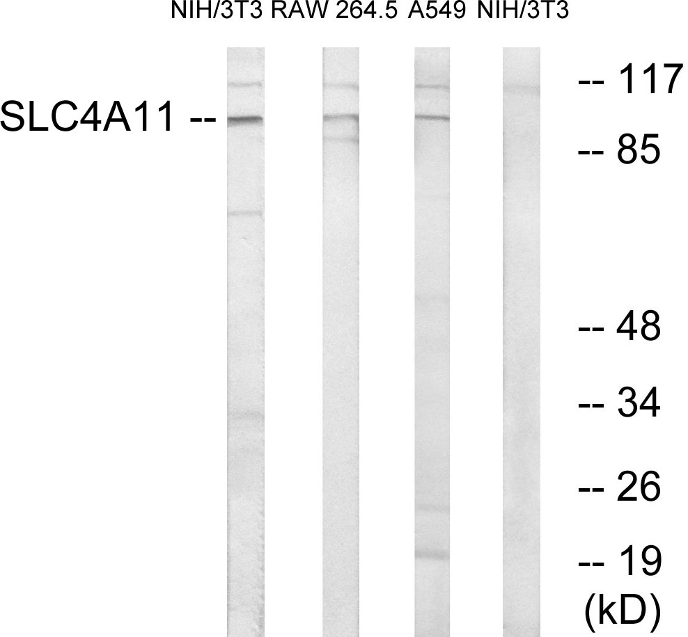 Anti-SLC4A11 antibody (GTX87741) | GeneTex