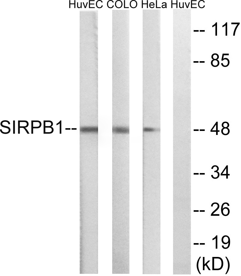 Anti-SIRP beta 1 antibody (GTX87943) | GeneTex