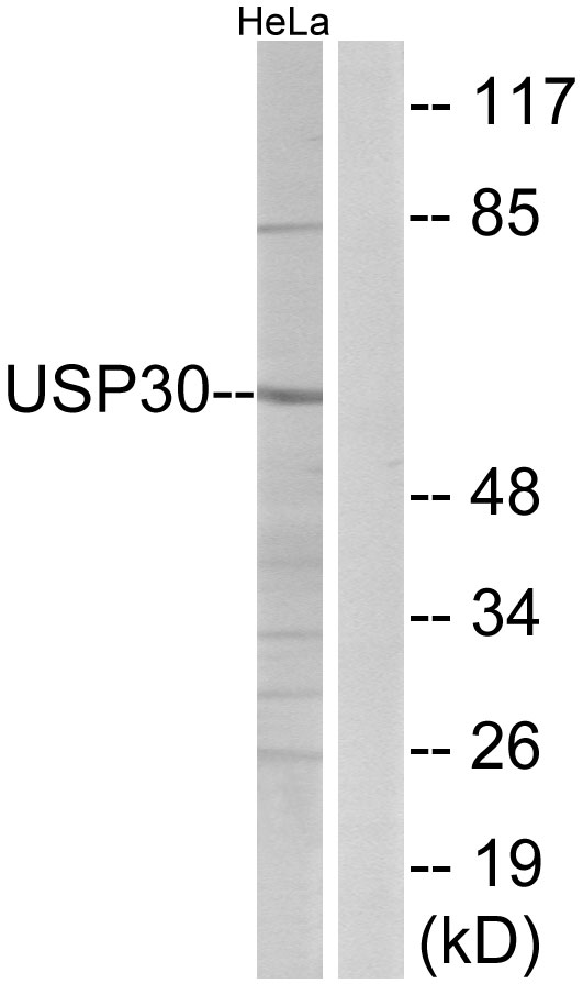 Anti-USP30 antibody (GTX87959) | GeneTex