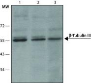 Anti-beta Tubulin 3/ Tuj1 antibody [SDL.3D10] (GTX11314) | GeneTex