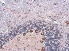 Anti-CGRP antibody (GTX134005) | GeneTex