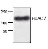 Anti-HDAC7 antibody (GTX21441) | GeneTex
