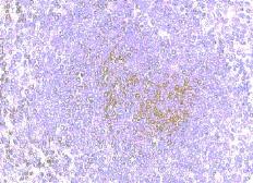 Anti-CCR8 antibody (GTX21665) | GeneTex