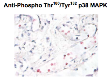 Anti-p38 MAPK (phospho Thr180/Tyr182) antibody (GTX48614) | GeneTex