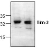Anti-TIM-3 antibody (GTX59896) | GeneTex