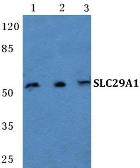 Anti-SLC29A1 antibody (GTX66737) | GeneTex
