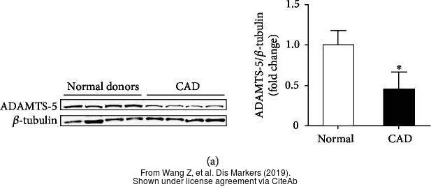 Anti-ADAMTS5 antibody (GTX100332) | GeneTex