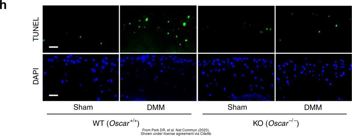 Anti-ADAMTS5 antibody (GTX100332) | GeneTex