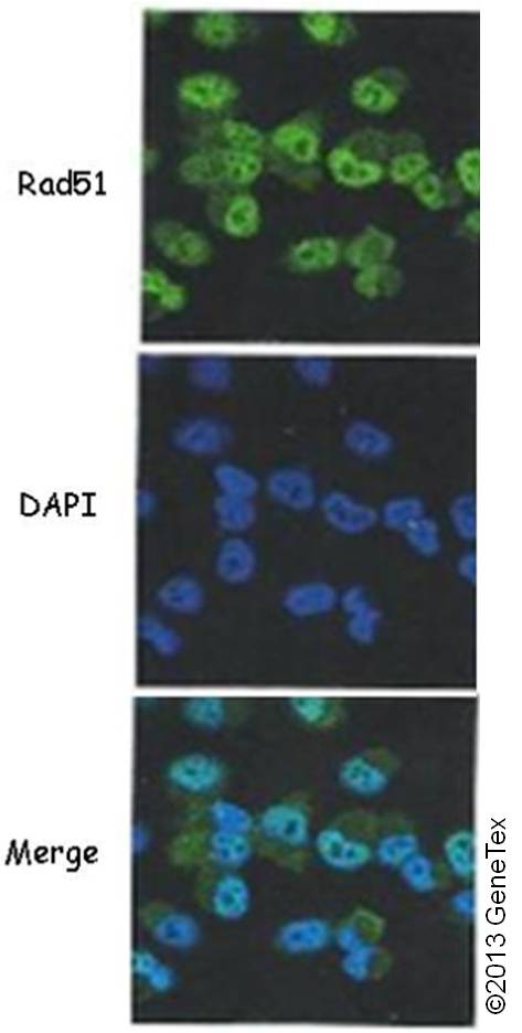 Anti-Rad51 antibody [N1C2] (GTX100469) | GeneTex