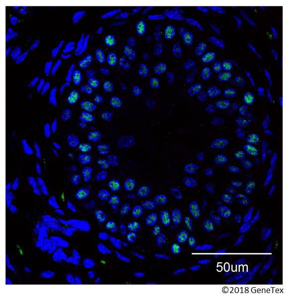 Anti-p63 antibody [N2C1], Internal (GTX102425) | GeneTex