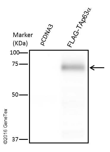 Anti-p63 antibody [N2C1], Internal (GTX102425) | GeneTex