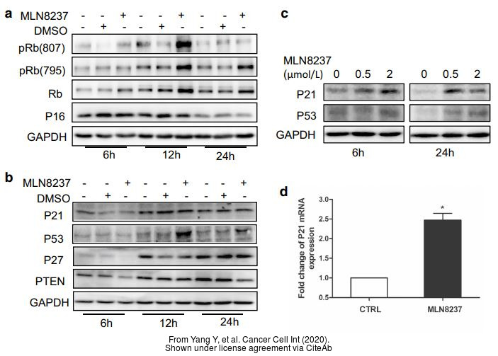 Anti-p53 antibody (GTX102965) | GeneTex