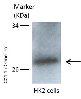 Anti-CLPP antibody [C2C3], C-term (GTX104656) | GeneTex