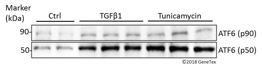 Anti-ATF6 antibody [C3], C-term (GTX104820) | GeneTex