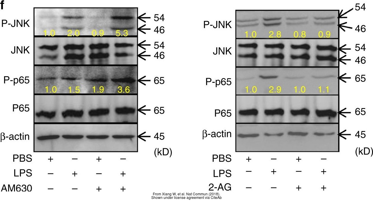 Anti-NFkB p65 antibody (GTX107678) | GeneTex