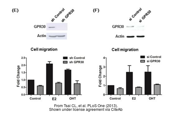 Anti-GPR30 antibody [C2C3], C-term (GTX107748) | GeneTex