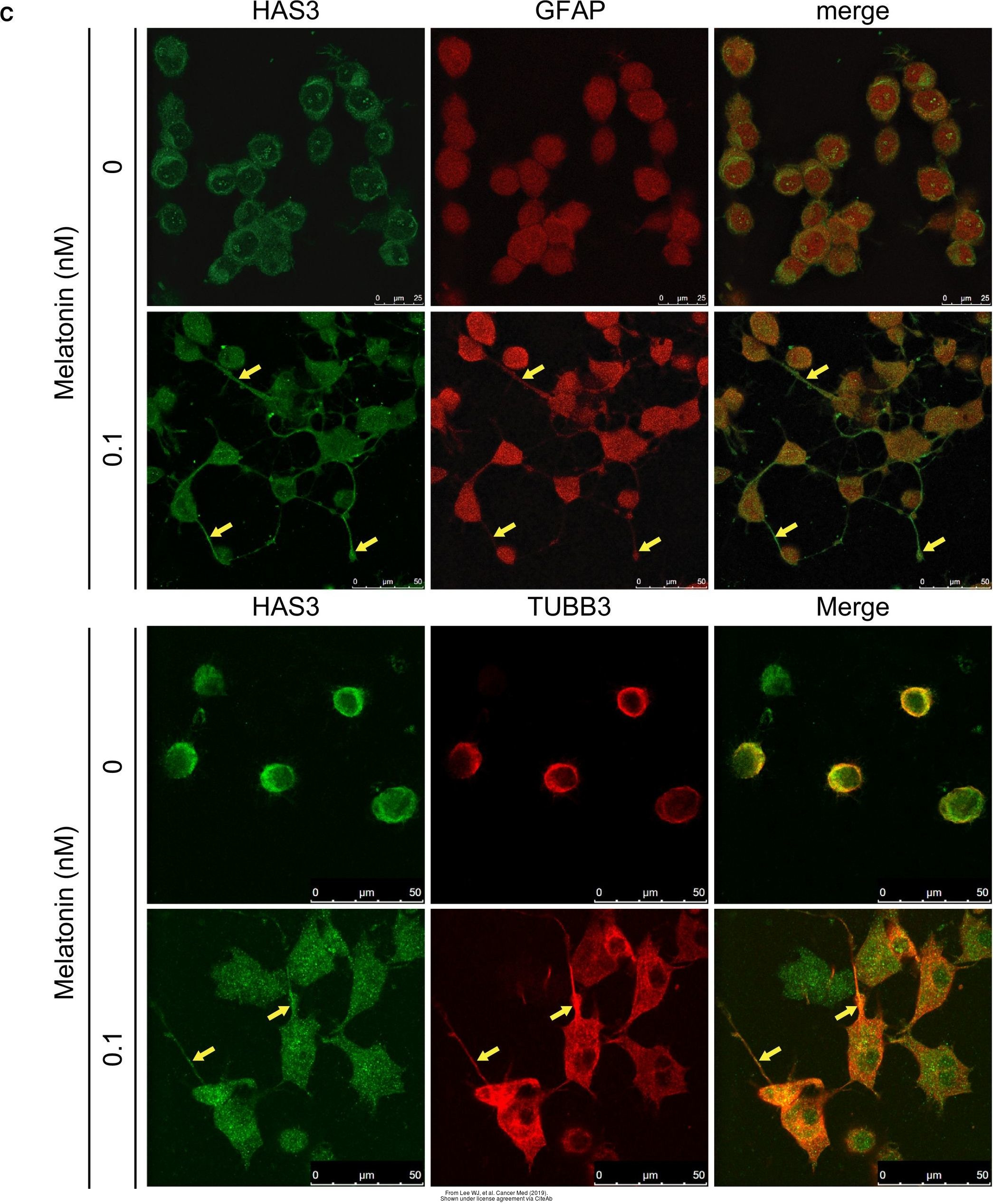 Anti-GFAP antibody (GTX108711) | GeneTex