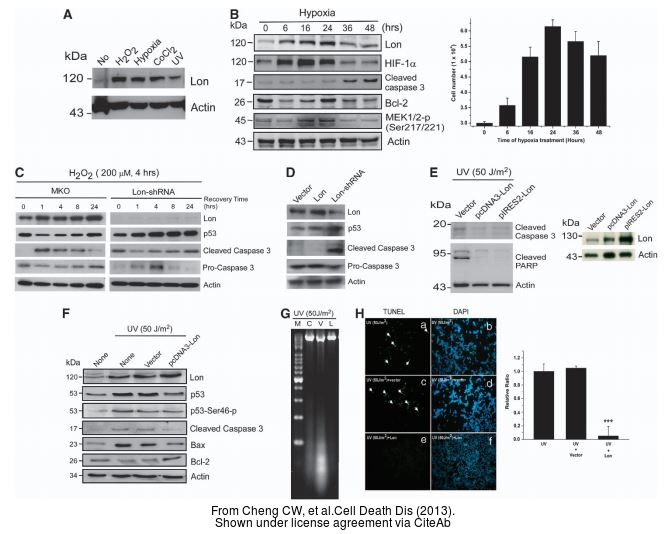 Anti-beta Actin antibody (GTX109639) | GeneTex