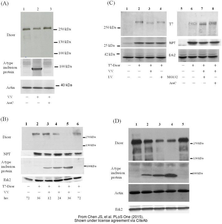 Anti-beta Actin antibody (GTX109639) | GeneTex