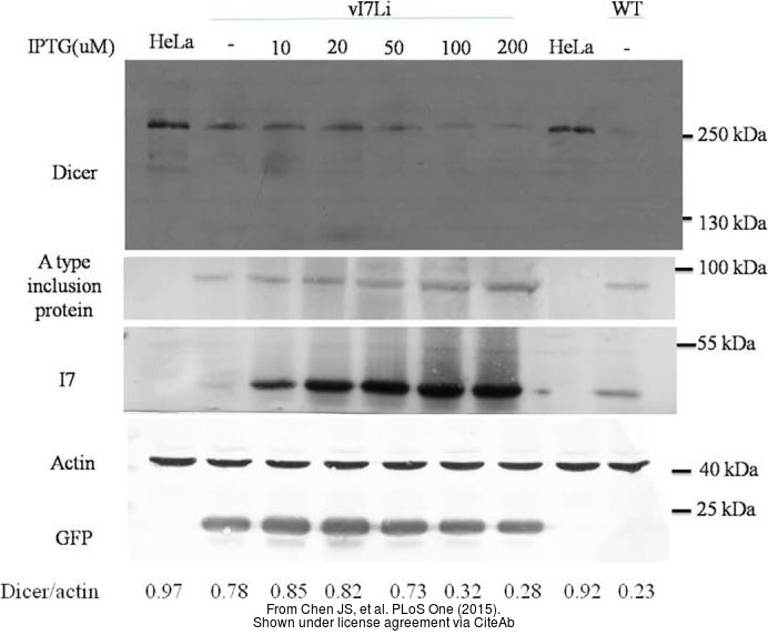 Anti-beta Actin antibody (GTX109639) | GeneTex