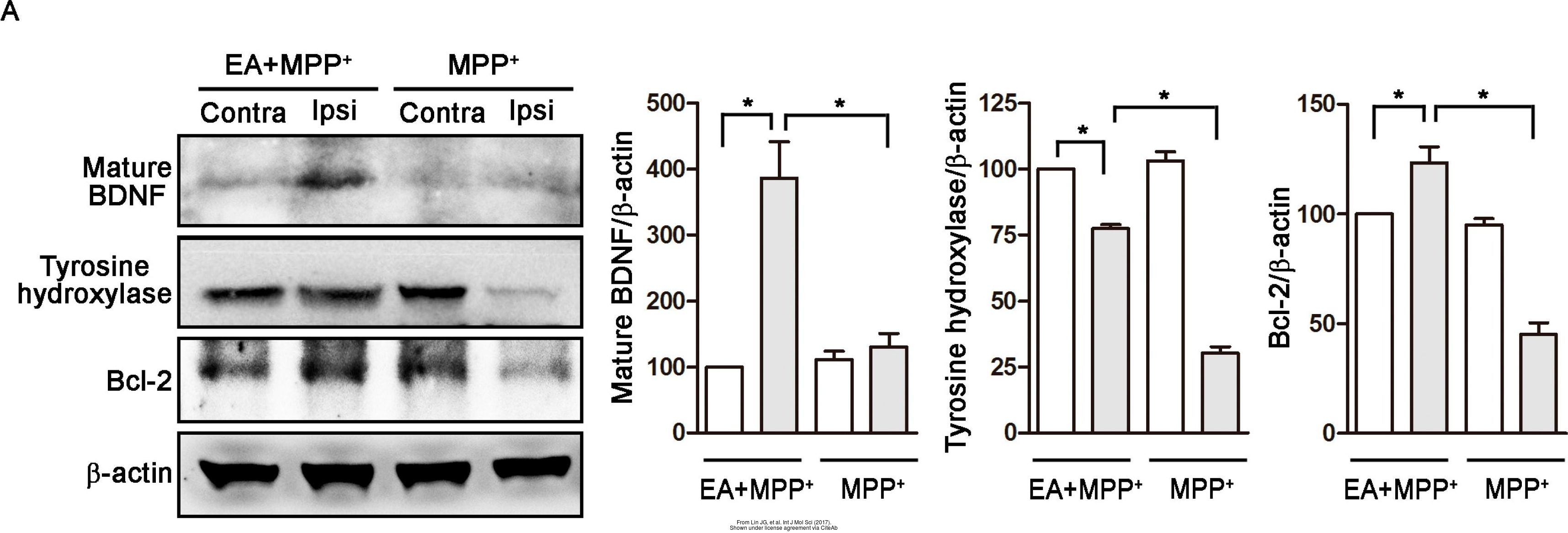 Anti-beta Actin antibody (GTX109639) | GeneTex