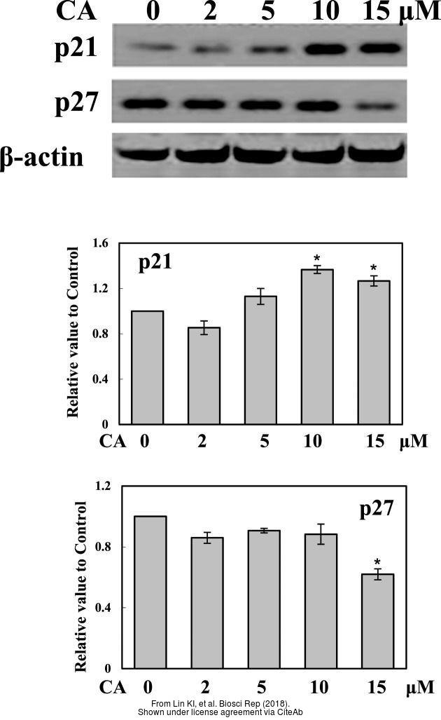 Anti-beta Actin antibody (GTX109639) | GeneTex