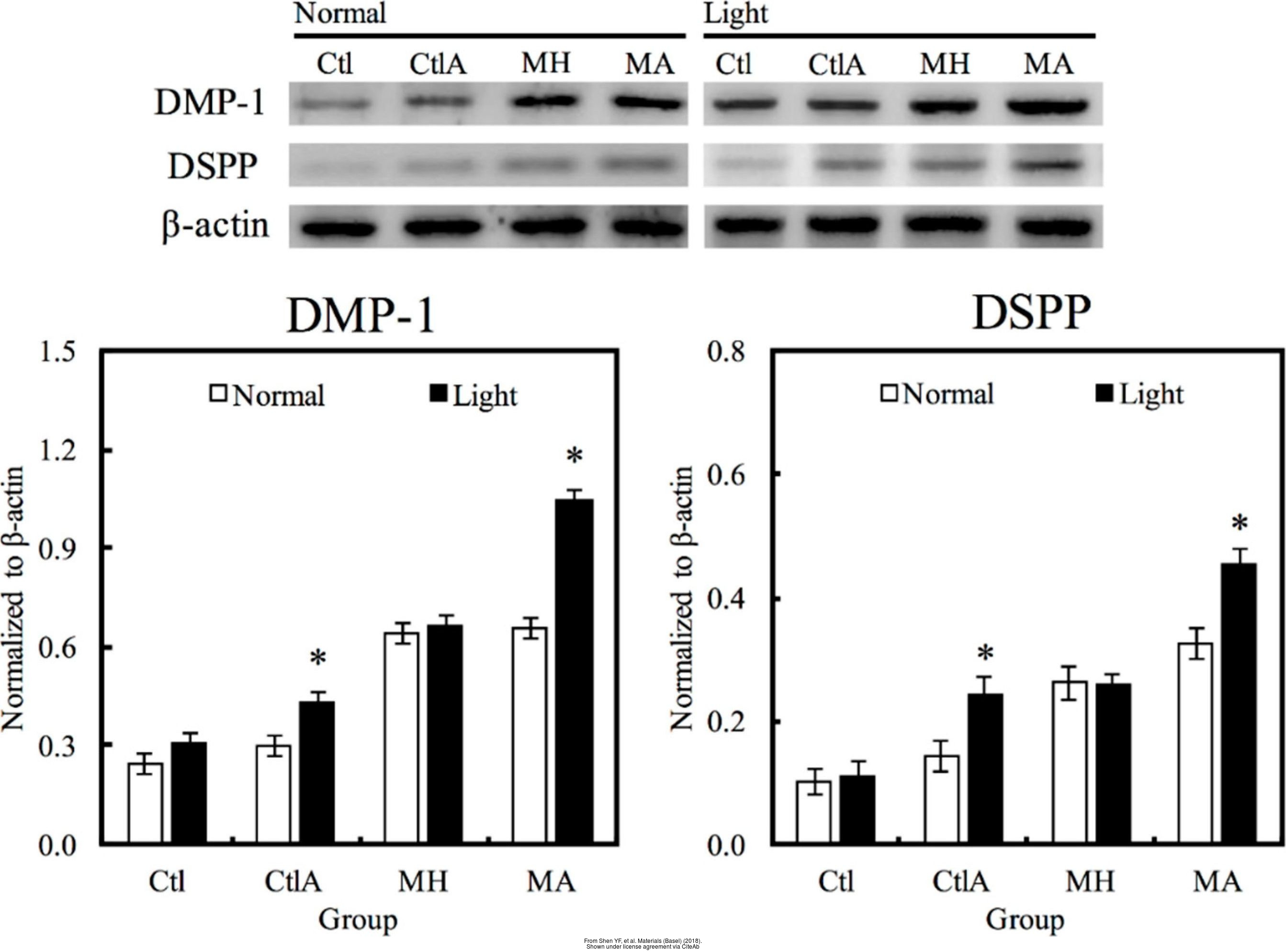 Anti-beta Actin antibody (GTX109639) | GeneTex