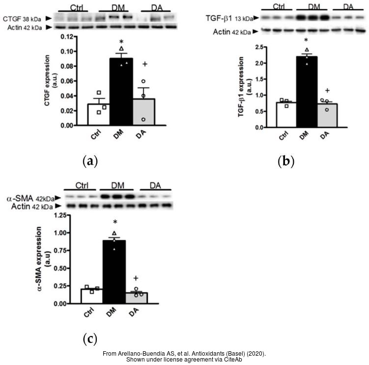 Anti-beta Actin antibody (GTX109639) | GeneTex