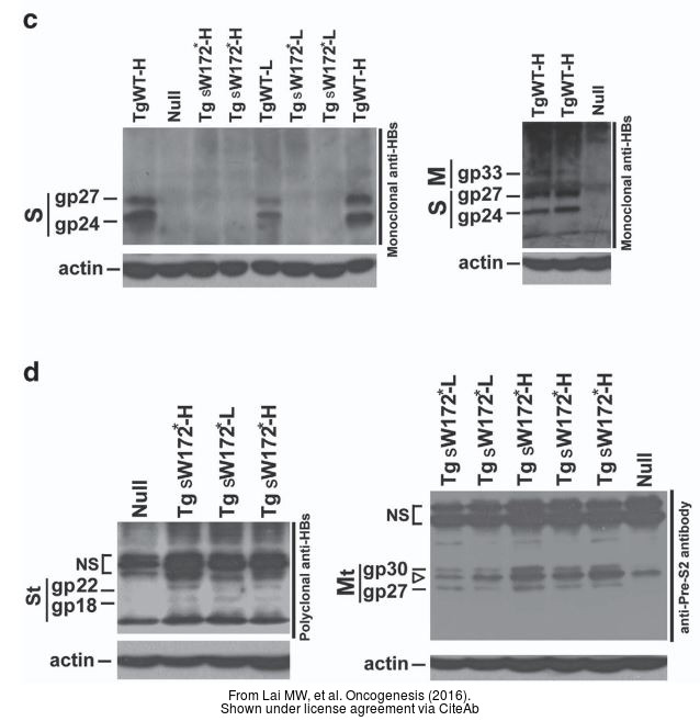 Anti-beta Actin antibody (GTX109639) | GeneTex