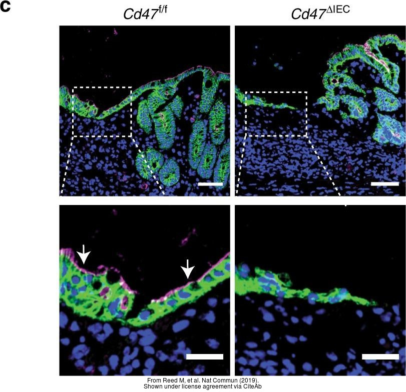Anti-Villin antibody (GTX109940) | GeneTex
