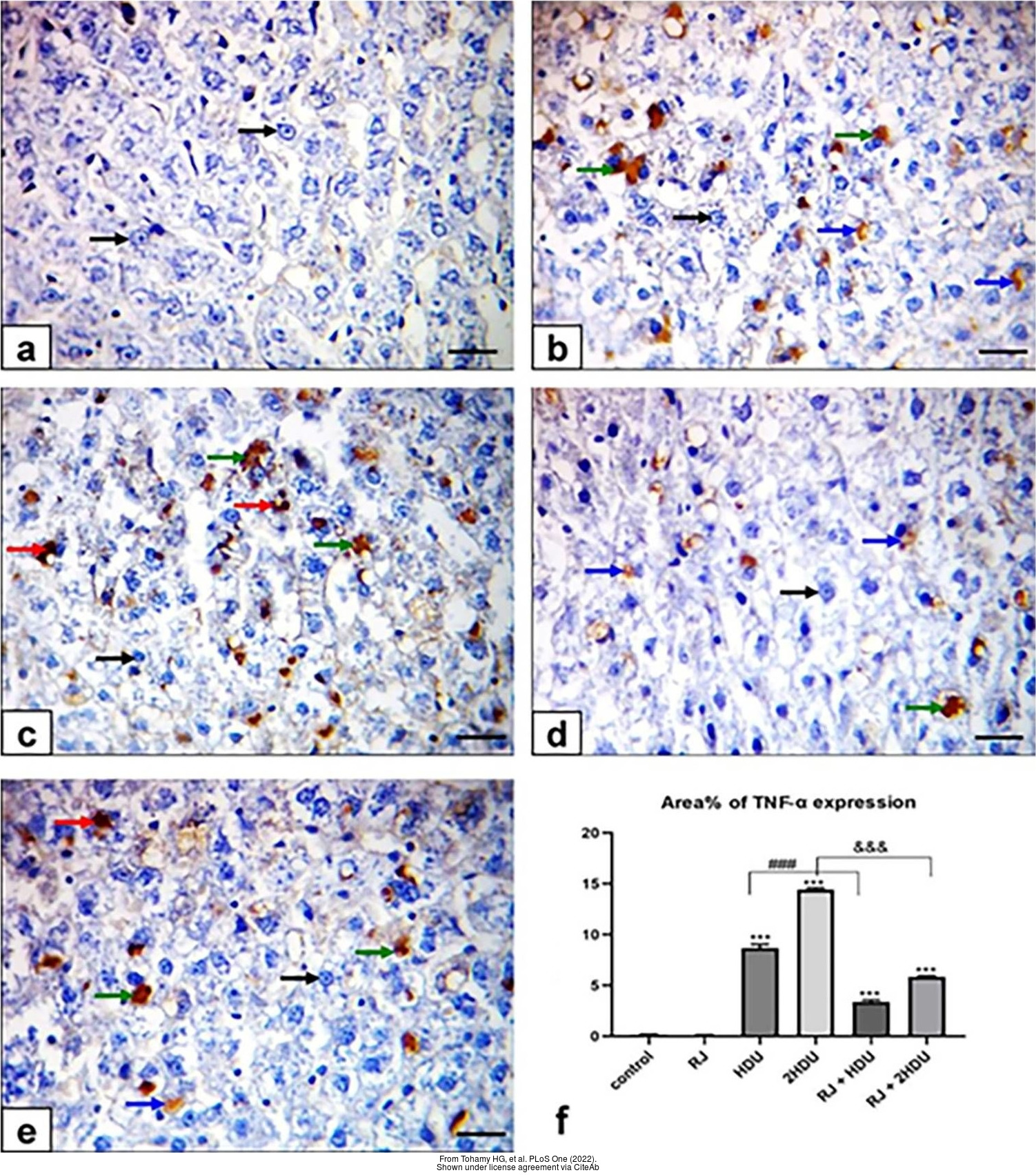 Anti-TNF alpha antibody (GTX110520) | GeneTex