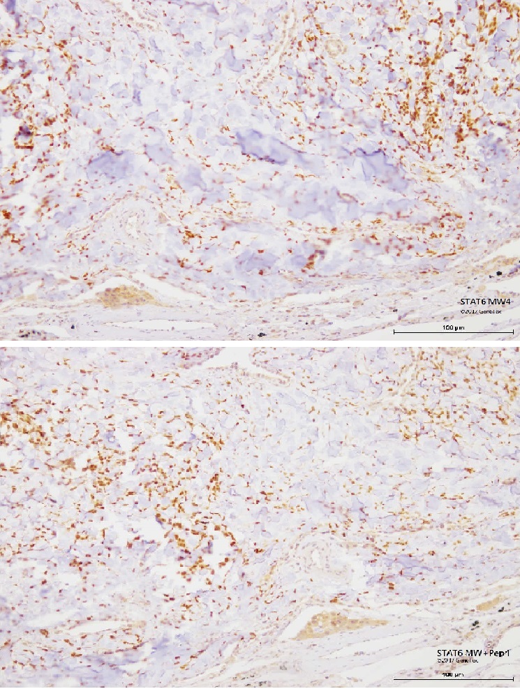 Anti-STAT6 antibody (GTX113273) | GeneTex