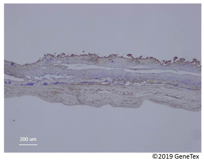 Anti-CD41 antibody [N2C1], Internal (GTX113758) | GeneTex