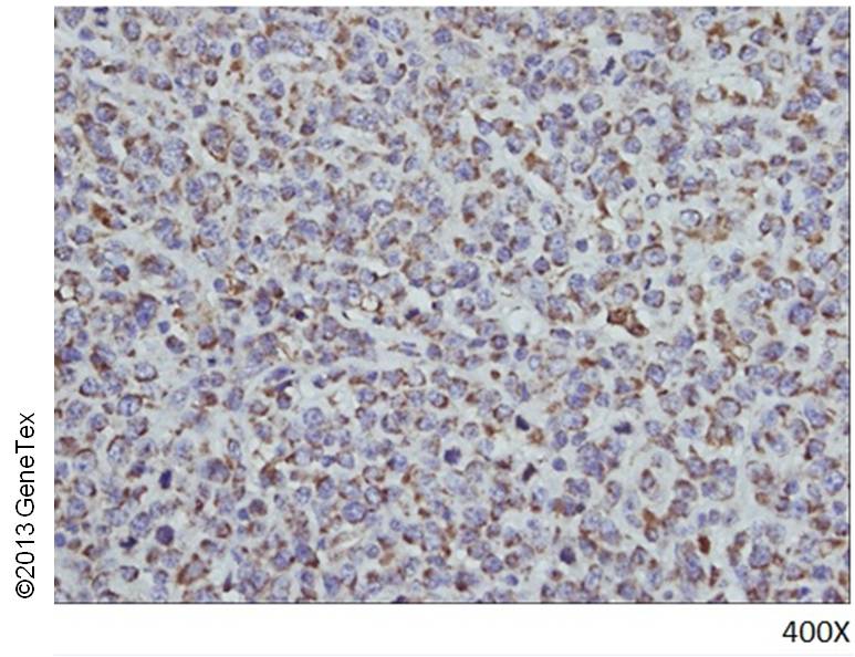 Anti-ACP2 antibody [N2C3] (GTX114234) | GeneTex