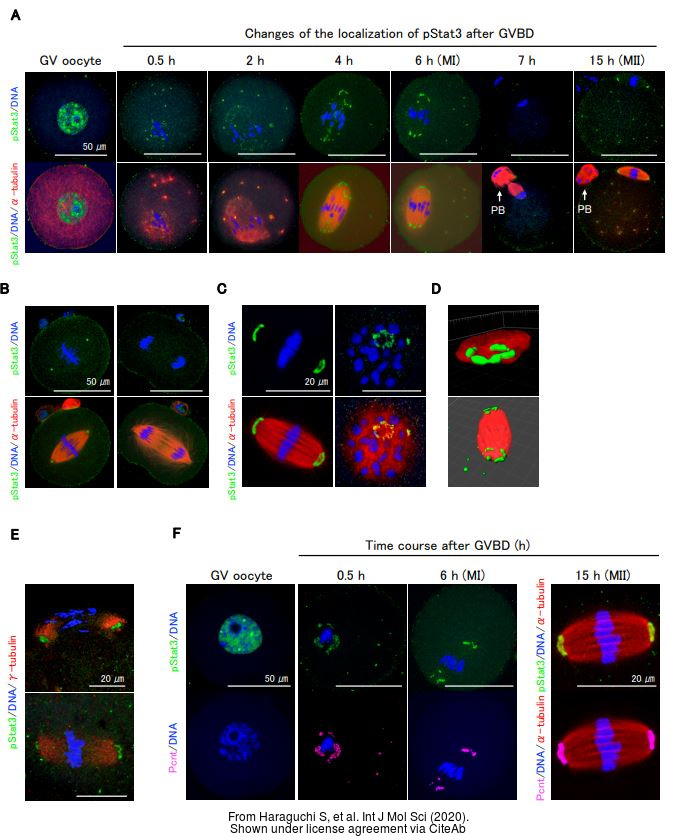Anti-STAT3 (phospho Tyr705) antibody (GTX118000) | GeneTex