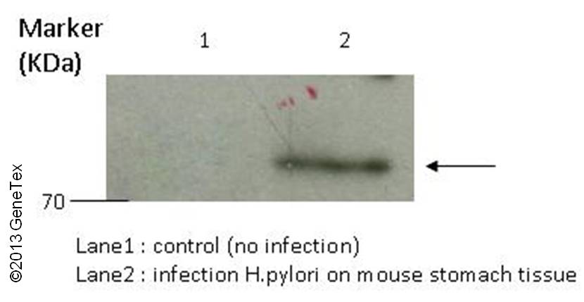 Anti-Helicobacter pylori urease B antibody (GTX124110) | GeneTex