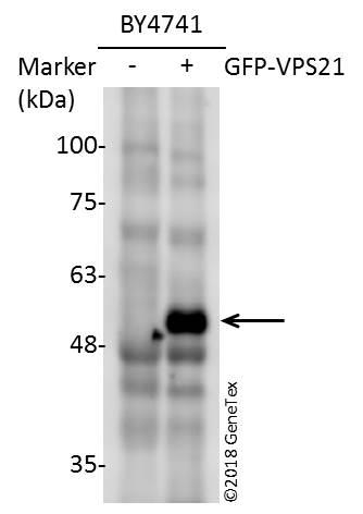 Anti-GFP antibody (GTX124117) | GeneTex