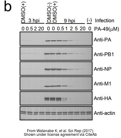 Anti-Influenza A virus PB1 protein antibody (GTX125923) | GeneTex