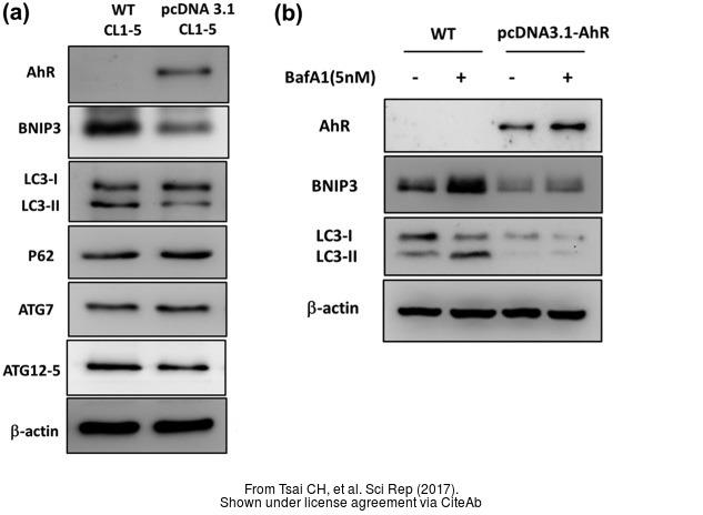 Anti-LC3B antibody (GTX127375) | GeneTex